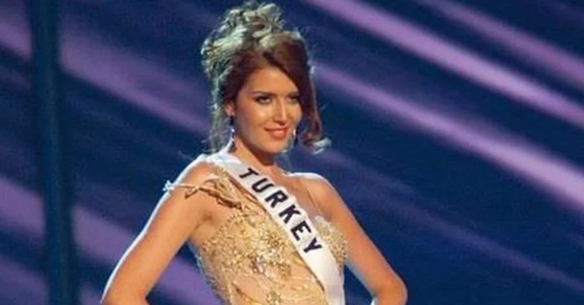 Senem Kuyucuoğlu’nun vücudu yandı